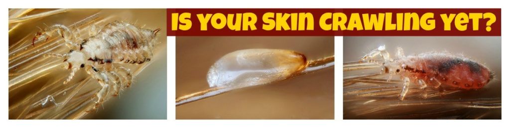 Facts About Head Lice | Just4KidsSalon